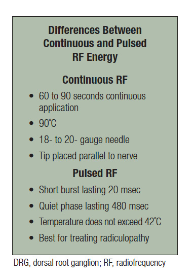 Clinical Applications of Radiofrequency Lesioning for Back and Neck Pain