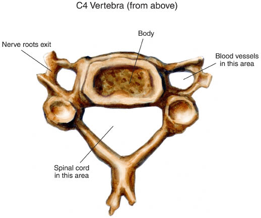 Neck Pain: Diagnosis And Management