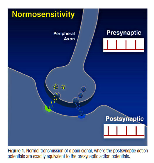 Demystifying Pain Pathways