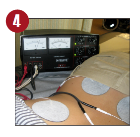 4. H-Wave Electrotherapy