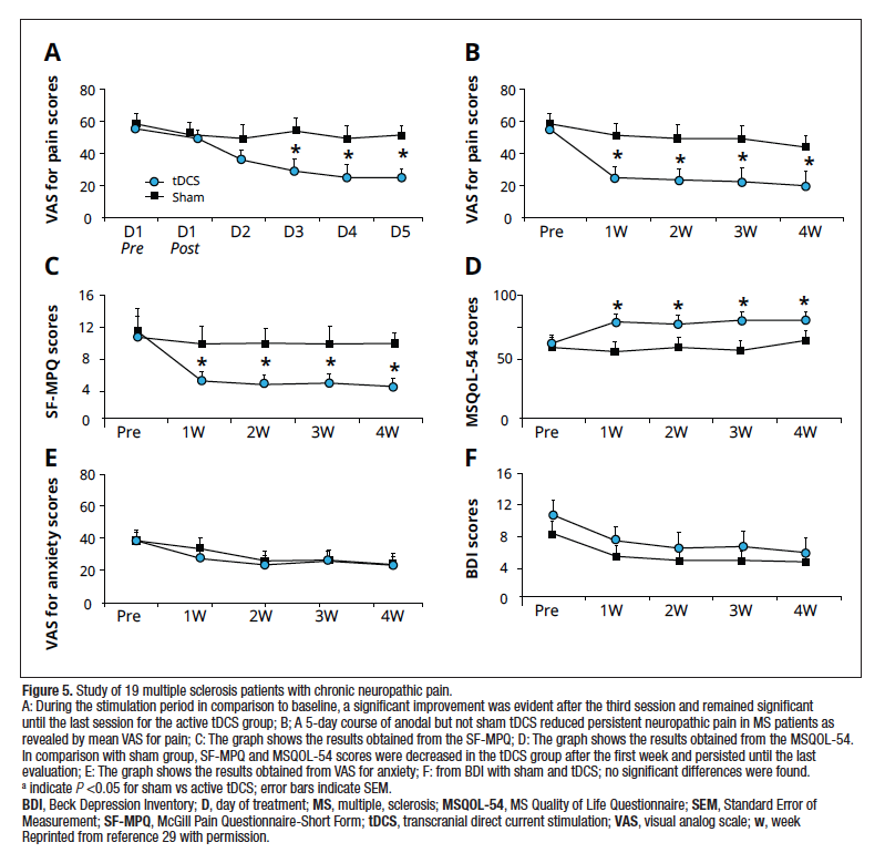 Transcranial Direct Current Stimulation (tDCS): What Pain Practitioners ...