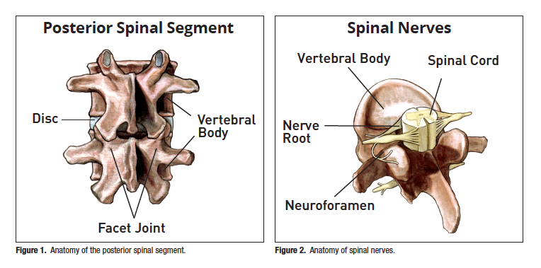 Selective Interventional Spinal Techniques: Injections and Ablations