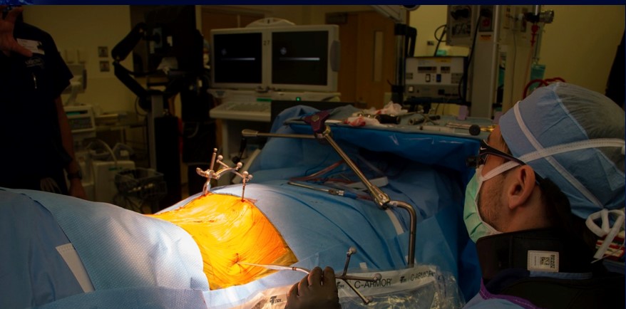 Single Position Spinal Surgery — Prone Lateral L3-L4