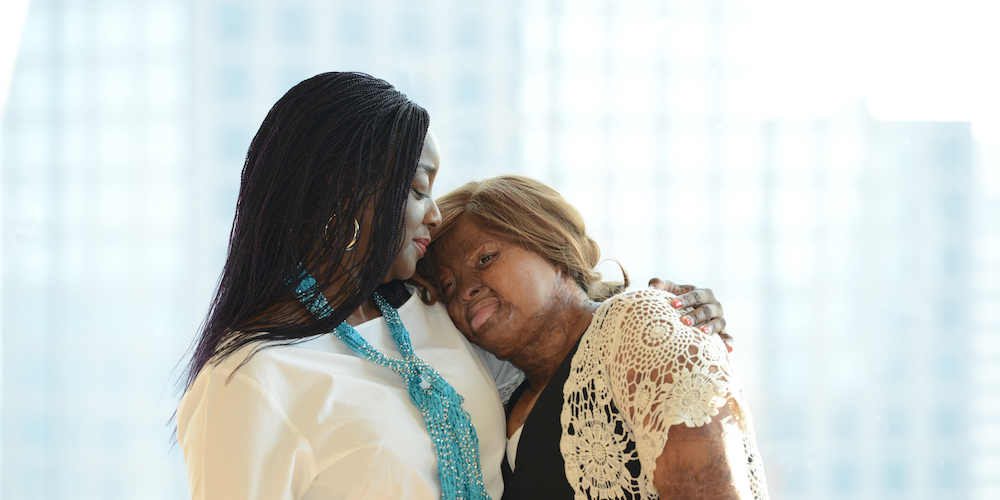 One Burn Survivor to Another: An Interview with Kechi Okwuchi