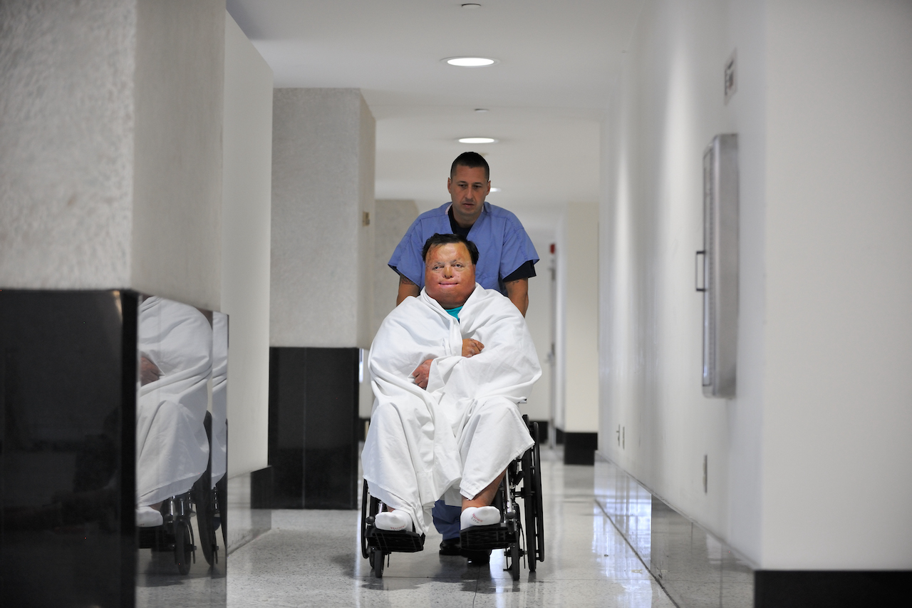 Post-Hospital Care: Understanding a Critical Stage of Burn Injury Recovery