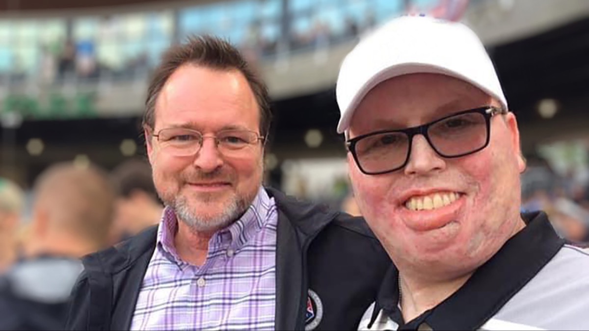 Burn Survivor SOARs to New Heights