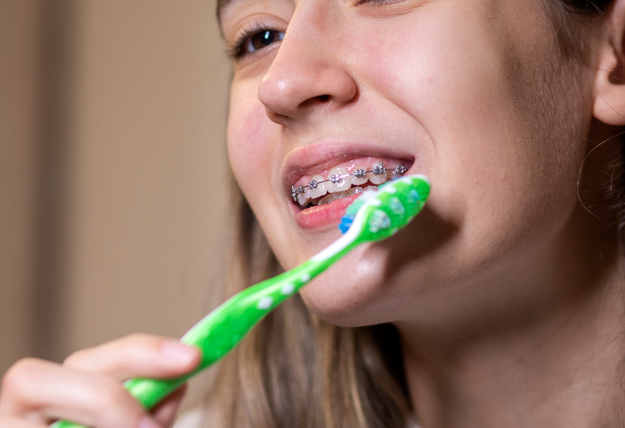 Skal alle barn ha fluortilskudd? - Apotek 1