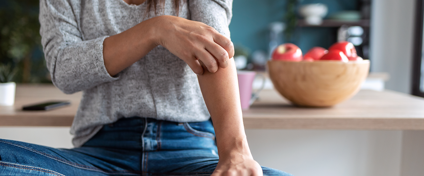 Skabb - smittsomt hudutslett som klør - Apotek 1