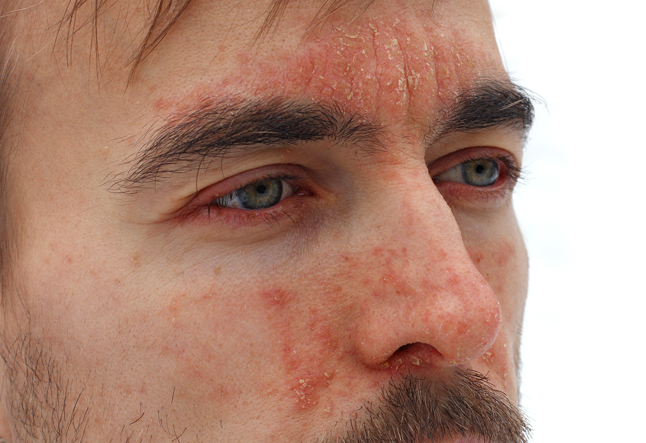 Ducray flass - Apotek 1