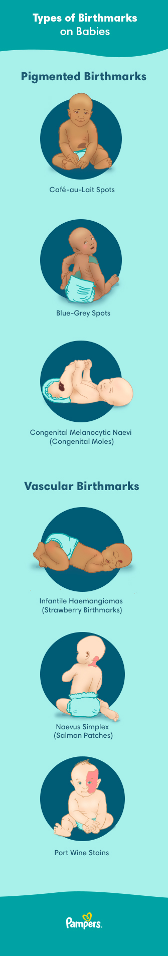 birthmark types