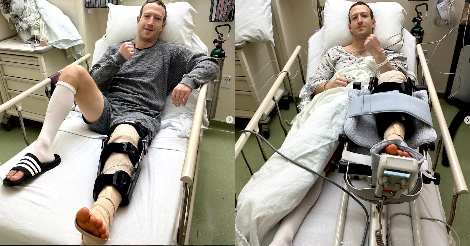 Meta CEO Mark Zuckerberg Undergoes Surgery After ACL Tear