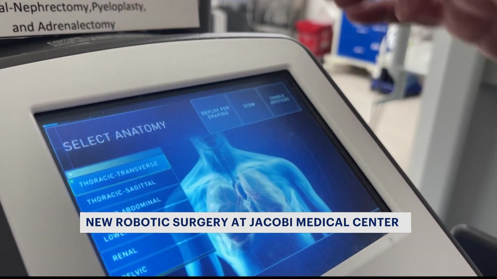 NYC Health + Hospitals/Jacobi rolls out surgical robot