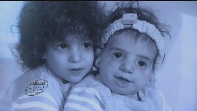 New film ‘Wonder’ shines spotlight on Treacher Collins syndrome