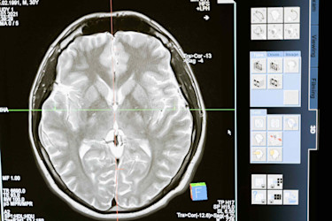 Neuroscience Passion Project & Research Topic Ideas | Polygence