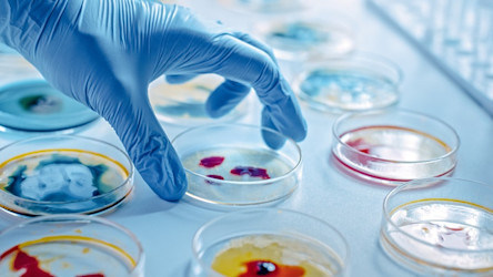 UCSD Microbiology Majors: Key Lab Technician Skills | Polygence