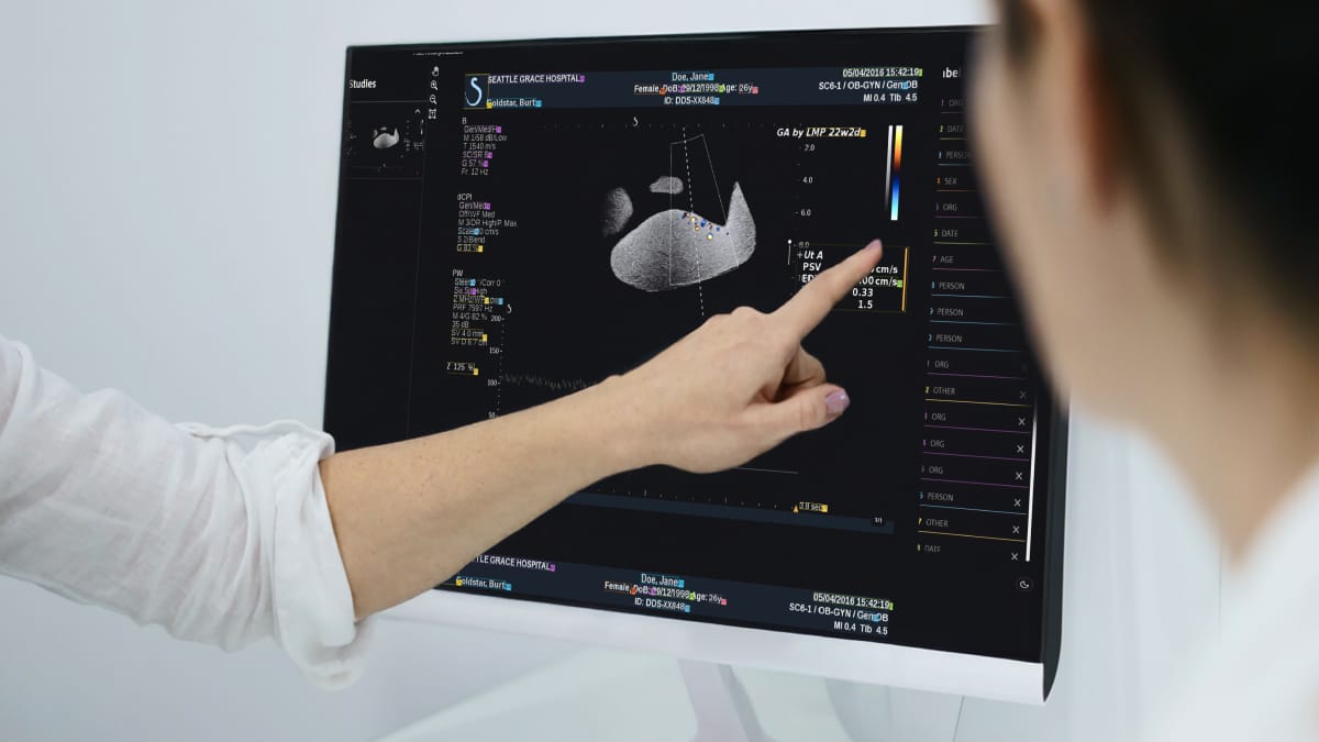 How We Unlocked Terabytes of Medical Data to Accelerate R&D | TELUS Digital