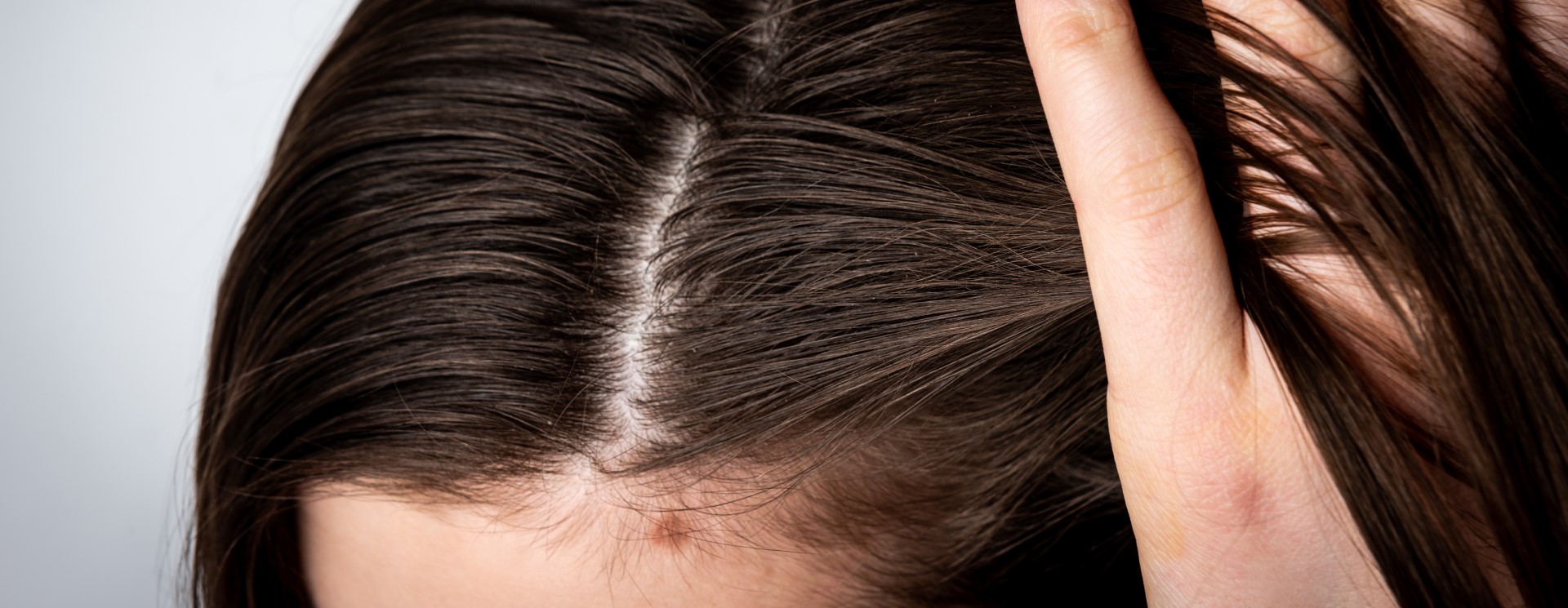 Problemas De Cabello Mixto En Chicas Tratamientos Para Cabello Mixto