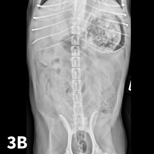 Top 5 Tips on Radiographic Diagnosis of Obstructive Foreign Bodies