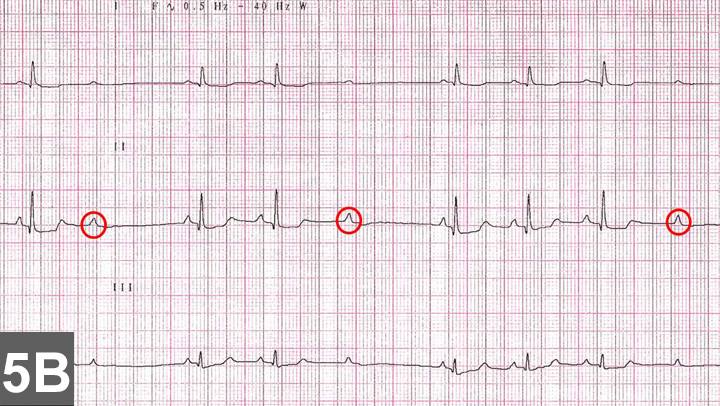 Top 5 Arrhythmias in Dogs & Cats | Clinician's Brief