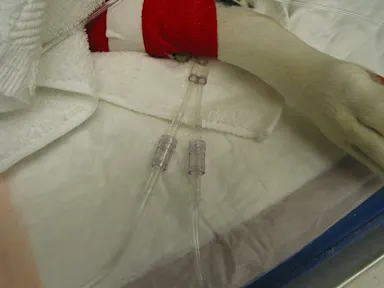 Constant-Rate Infusions: Practical Use