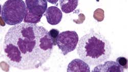 Anemia in a Cat—Can You Identify Why? | Clinician's Brief