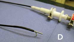 Caval Syndrome | Clinician's Brief