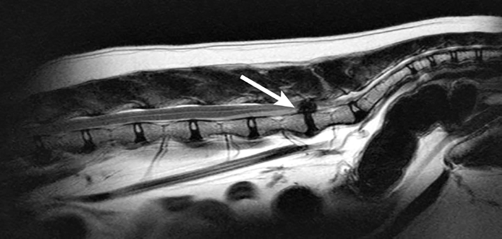 Treatment of Lumbosacral Disease | Clinician's Brief