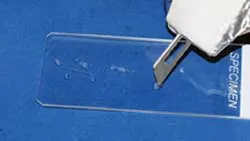 Corneal Cytology & Culture Collection