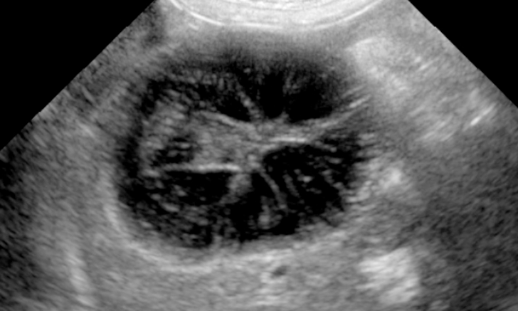 Top 5 Most Common Canine Biliary Diseases