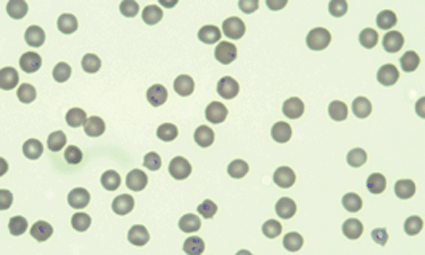 Feline Cytauxzoonosis: Fatal Infection