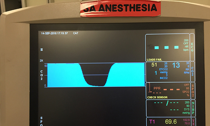 Image Gallery: Capnography