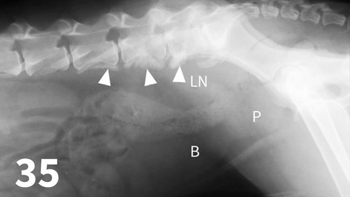 Imaging the Urinary Tract | Clinician's Brief