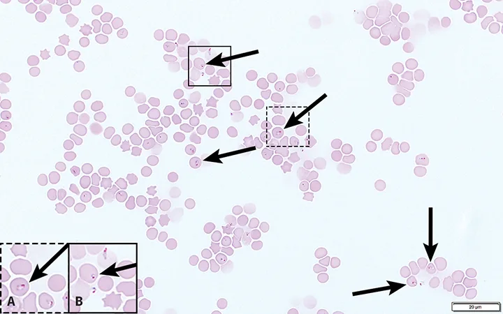 Clinical Image: Piroplasms