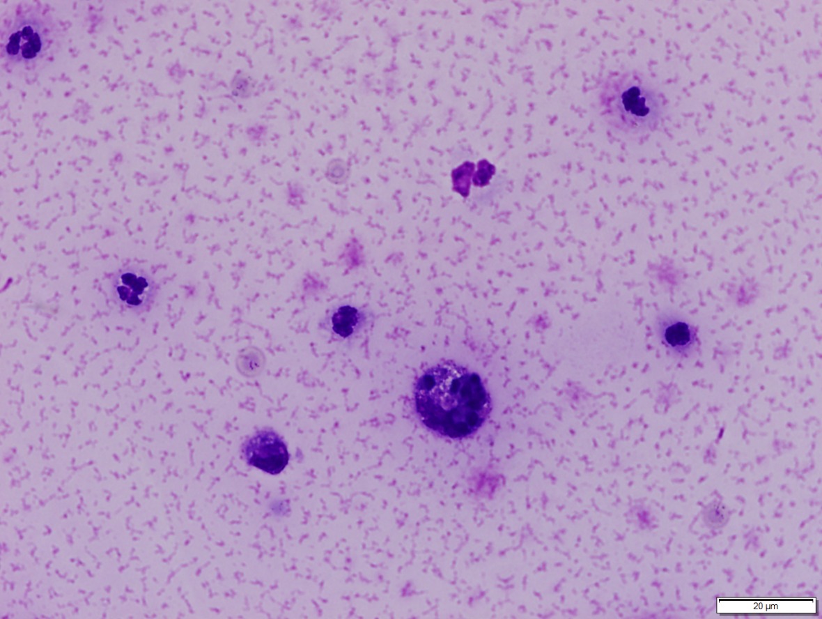 Clinical Image: Wet FIP Cavitary Smear