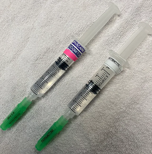 Locoregional Anesthesia Complications