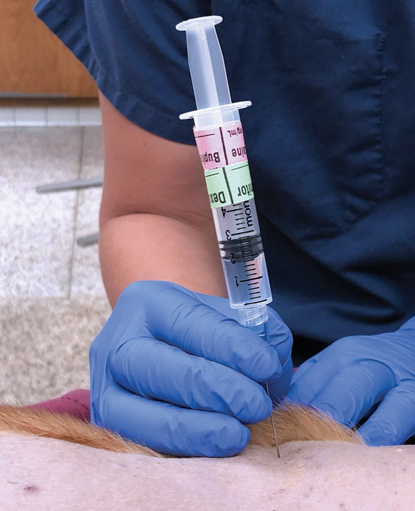 Intercostal Blocks for Rib Fractures | Clinician's Brief