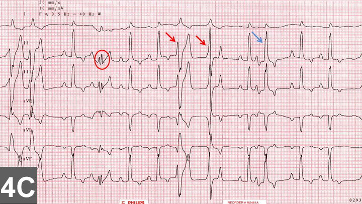 Top 5 Arrhythmias in Dogs & Cats | Clinician's Brief