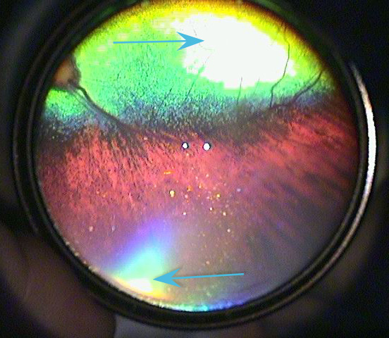 Image Gallery: Feline Fundus Diseases | Clinician's Brief