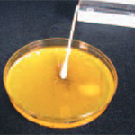 Fungal Cultures for Diagnosing Dermatophytosis | Clinician's Brief