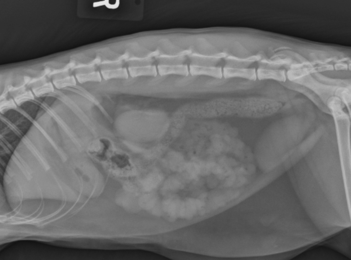 Clinical Image: Abdominal Radiograph
