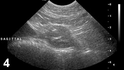 Prostatic Disease: An Overview Understanding Prostatic Disease ...