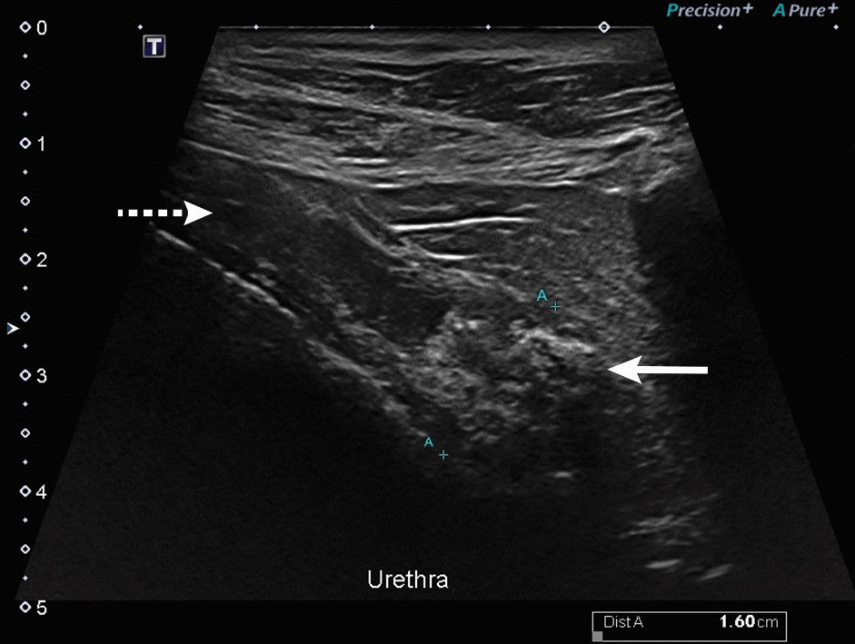 Top 6 Conditions Found During Canine Rectal Examination | Clinician's Brief