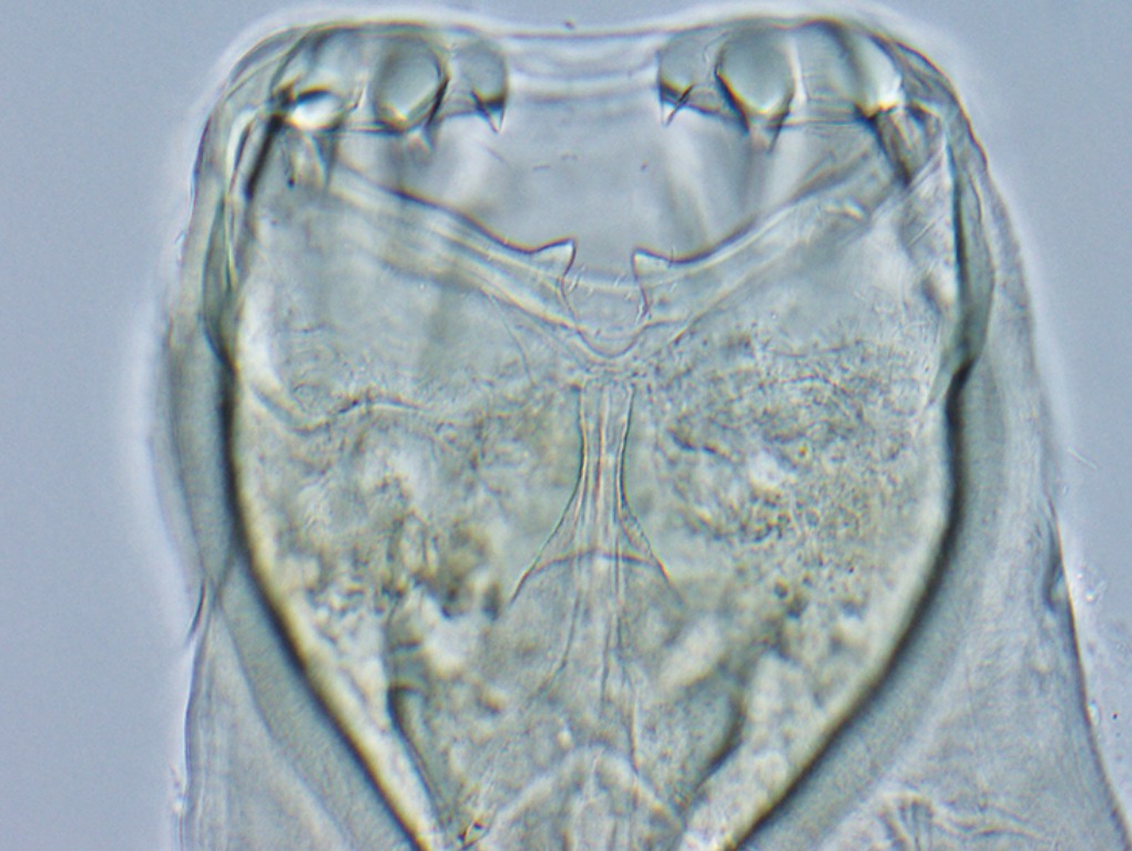 Clinical Image: Which Species Is This Parasite?
