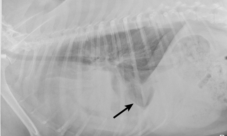 Podcast: Acute Pleural Effusion with Dr. Linklater