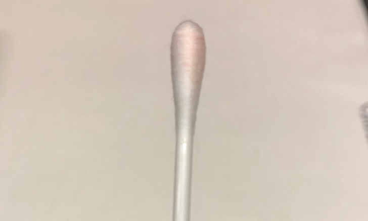 Wound Sampling for Culture & Cytology