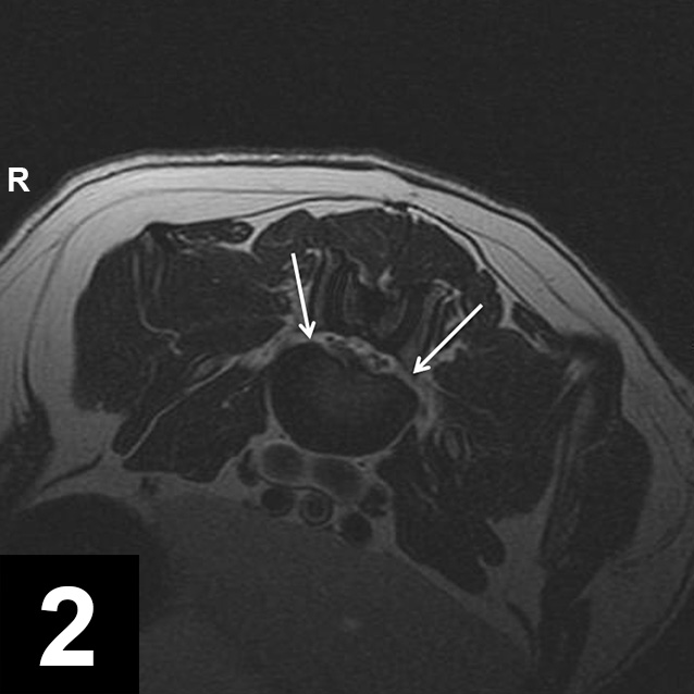 Ambulatory Paraparesis in a German Shepherd Dog | Clinician's Brief