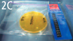 Fungal Cultures for Diagnosing Dermatophytosis | Clinician's Brief