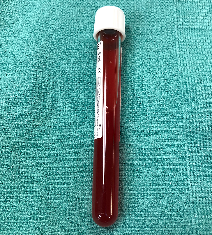 Acute Pleural Effusion in a Dog | Clinician's Brief