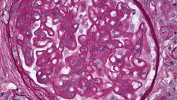 Proteinuria in Dogs and Cats | Clinician's Brief