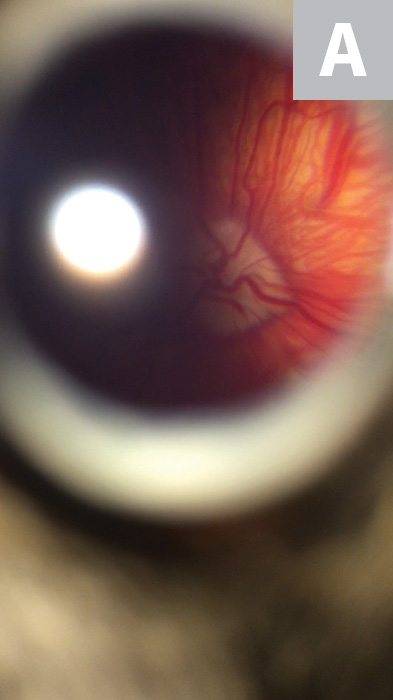 Smartphone Technology in Clinical Ophthalmology | Clinician's Brief